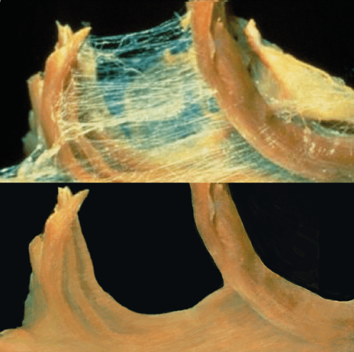 Restoration of Your Scar Tissue - Muscle & Joint Clinic